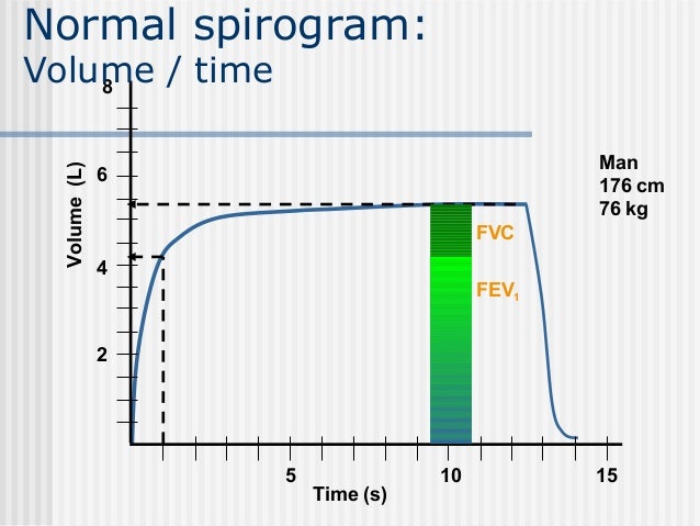 Spirometry