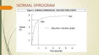 Spirometry | PPTX