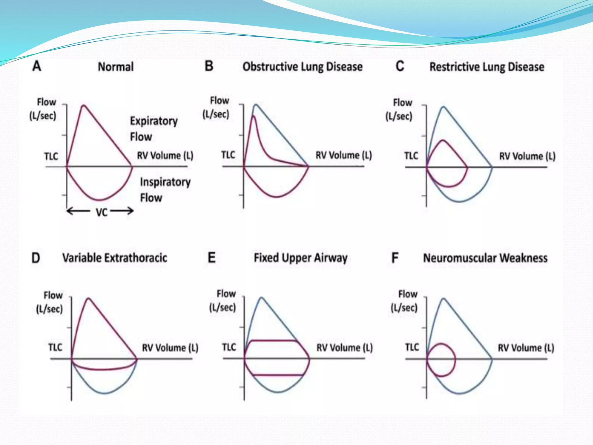 Spirometry | PPT