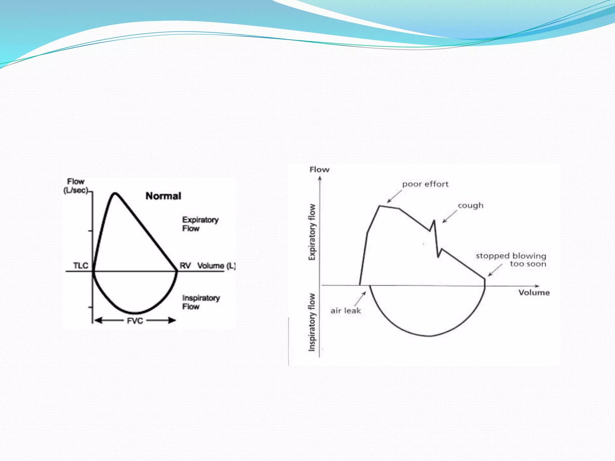 Spirometry | PPT