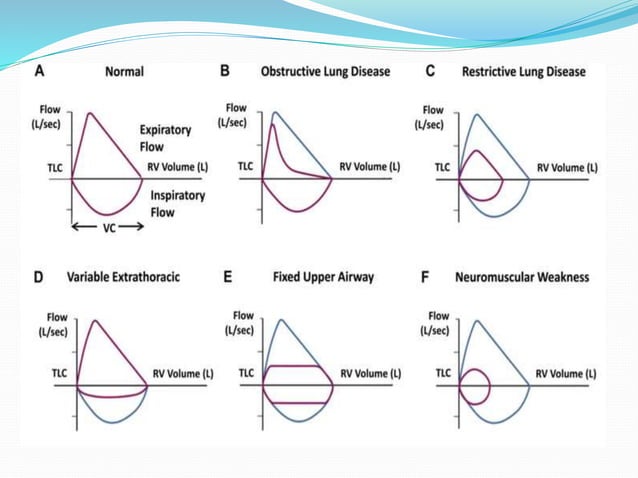 Spirometry | PPTX | Lung and Respiratory Health | Diseases and Conditions