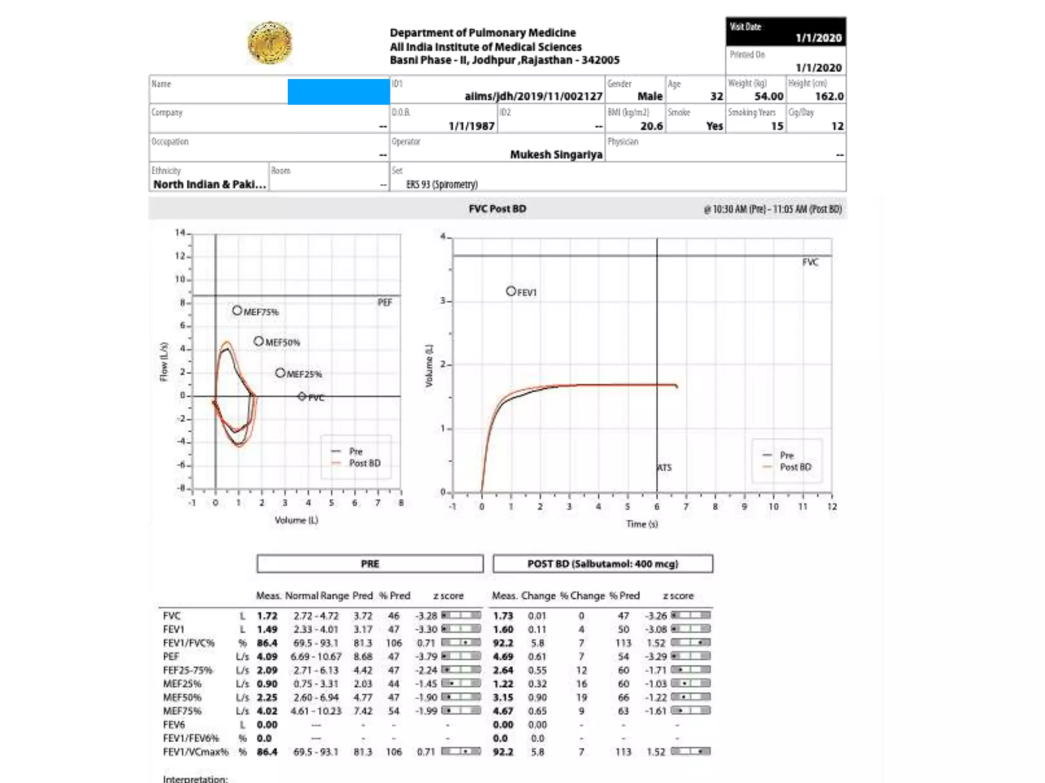 Spirometry | PPTX