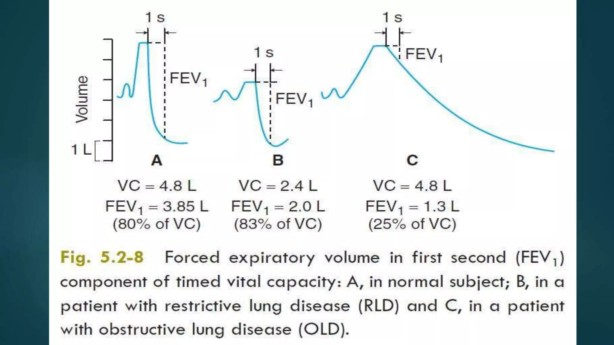 spirometry.pptx