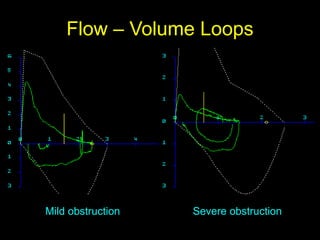 Information About Spirometry | Jindal Chest Clinic | PPT
