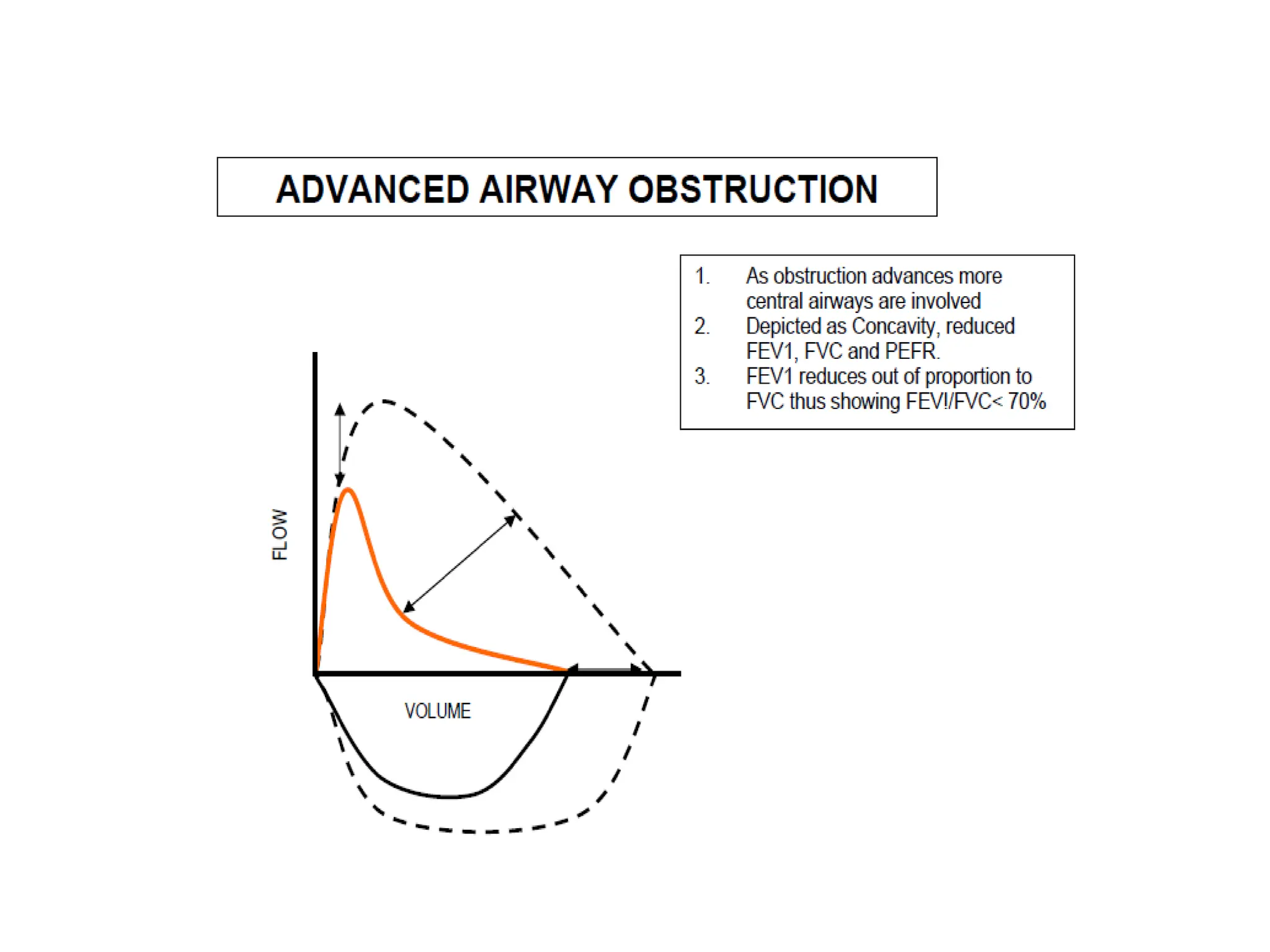 spirometry.ppt by dr Payal Gawai detailed review | PPT