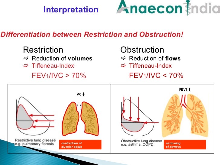 Anaecon India - Spirometery