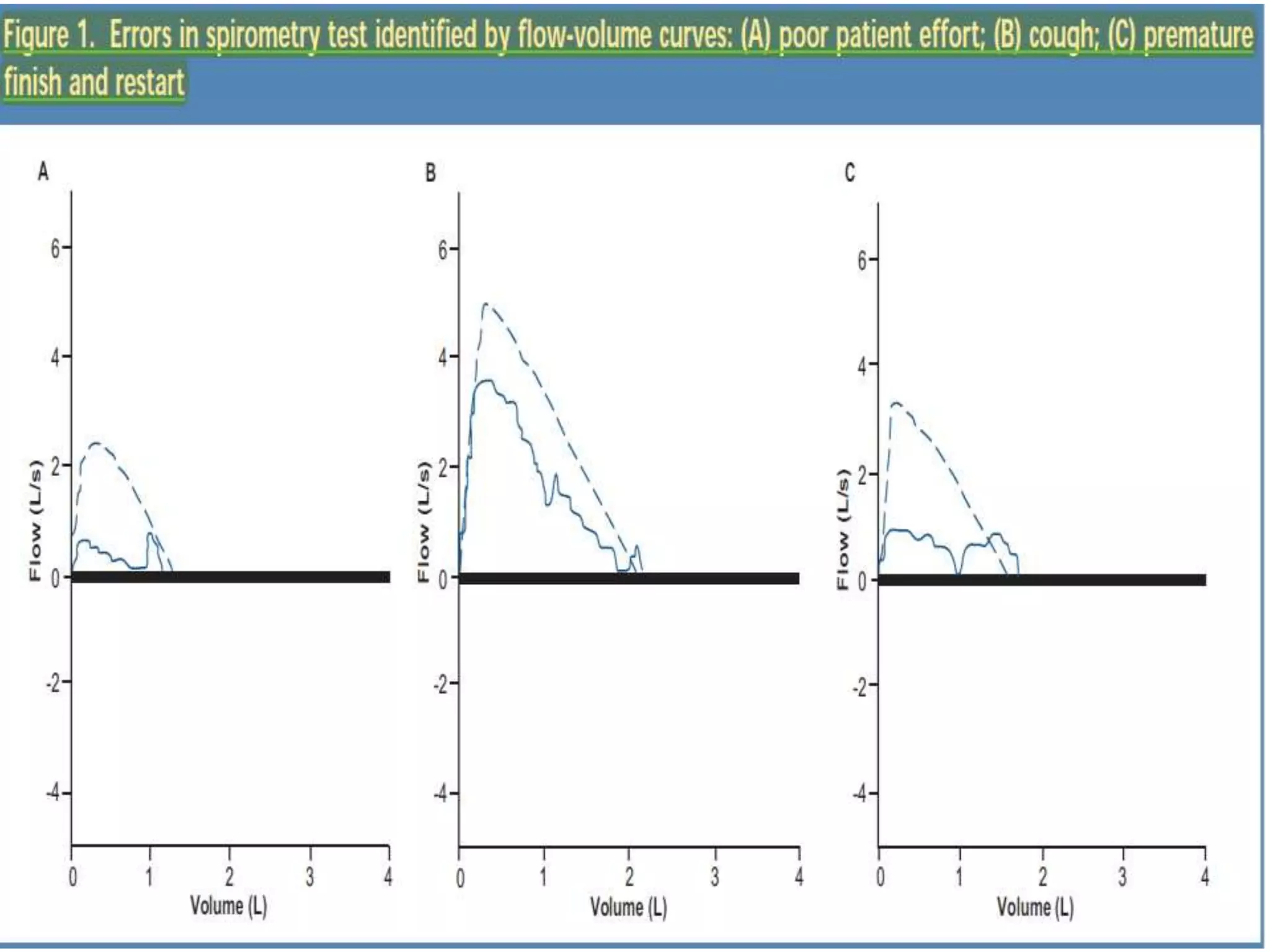 Spirometry in children | PPT