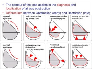 Spirometry workshop | PPT