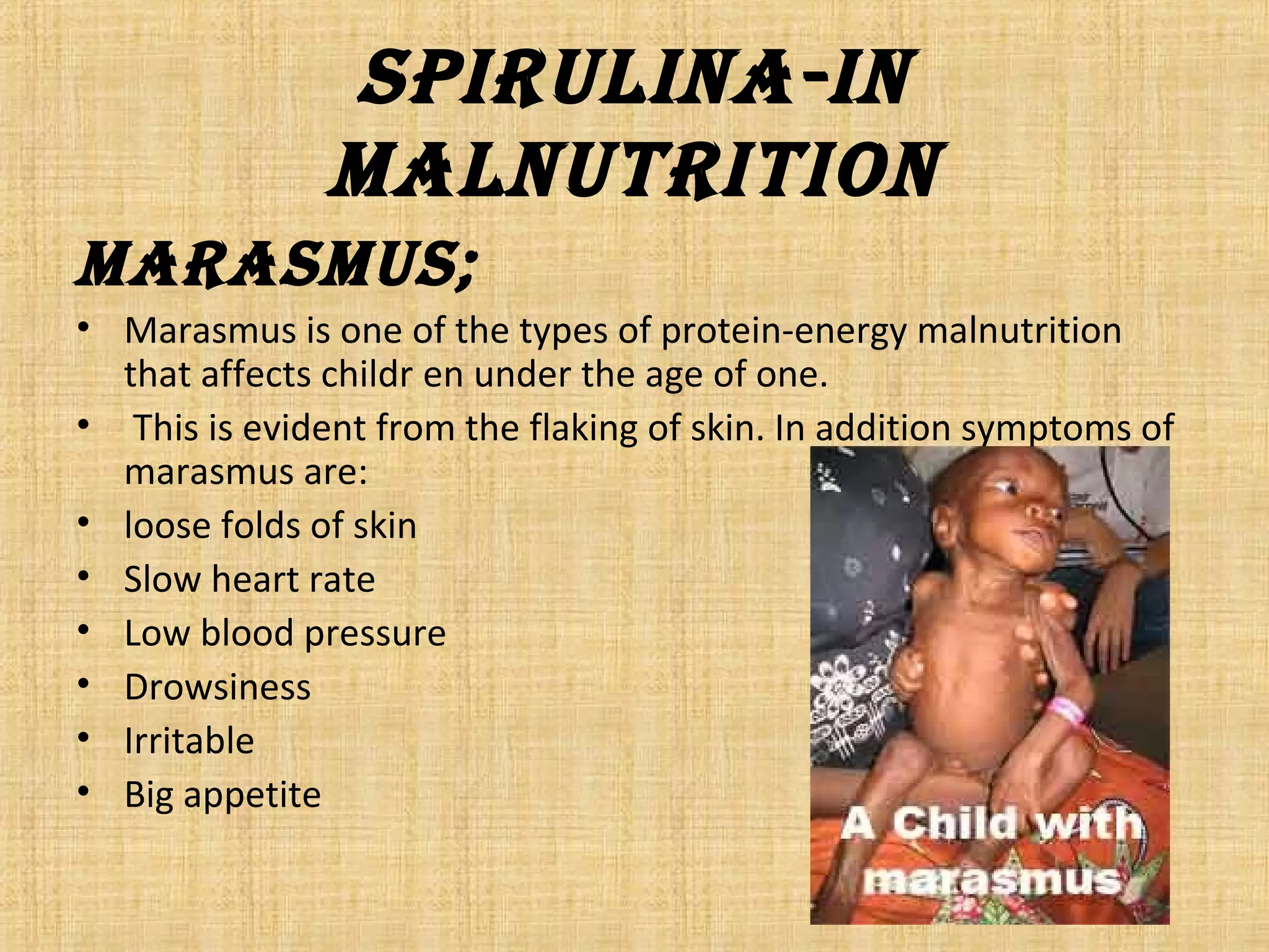 Spirulina | PPT