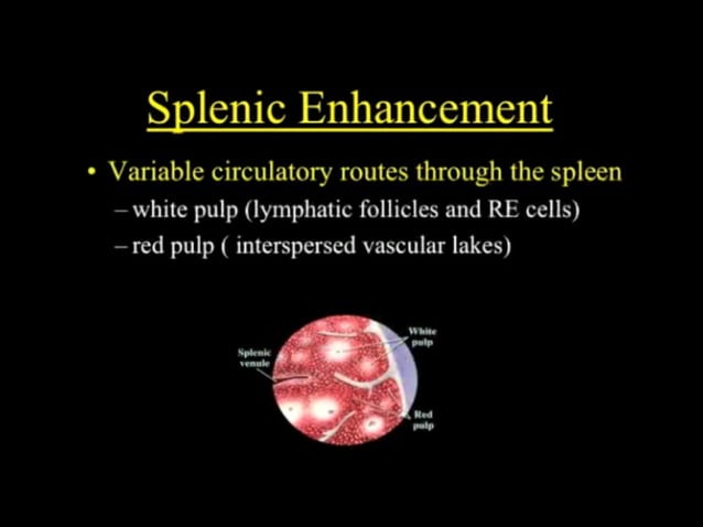 Spleen | PPT