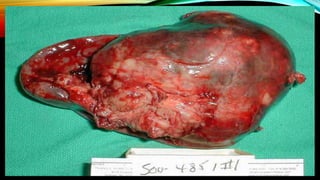 anatomy of spleen | PPTX