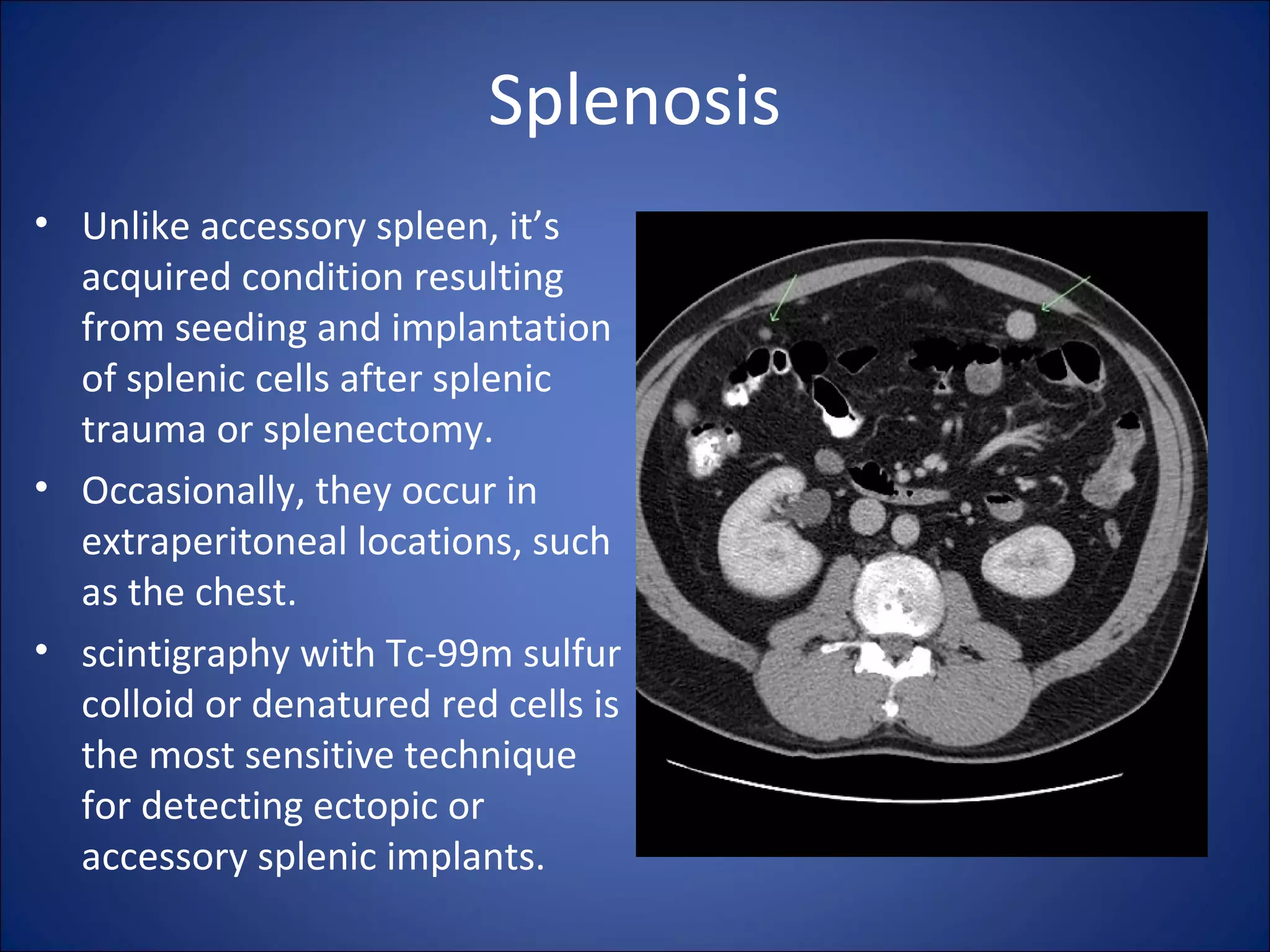 Spleen; Imaging Anatomy, Investigations and Pathology | PPT