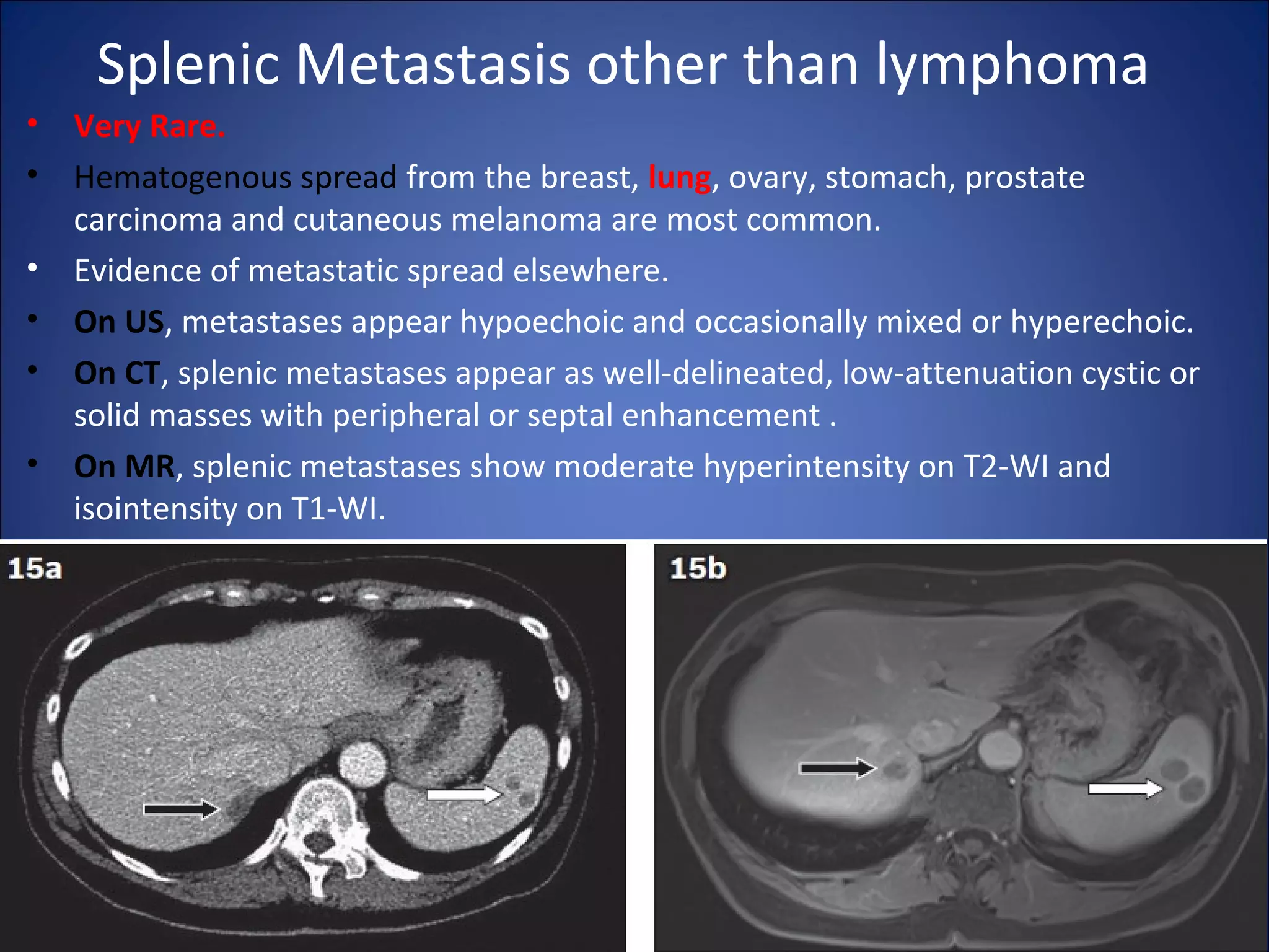 Spleen; Imaging Anatomy, Investigations and Pathology | PPT
