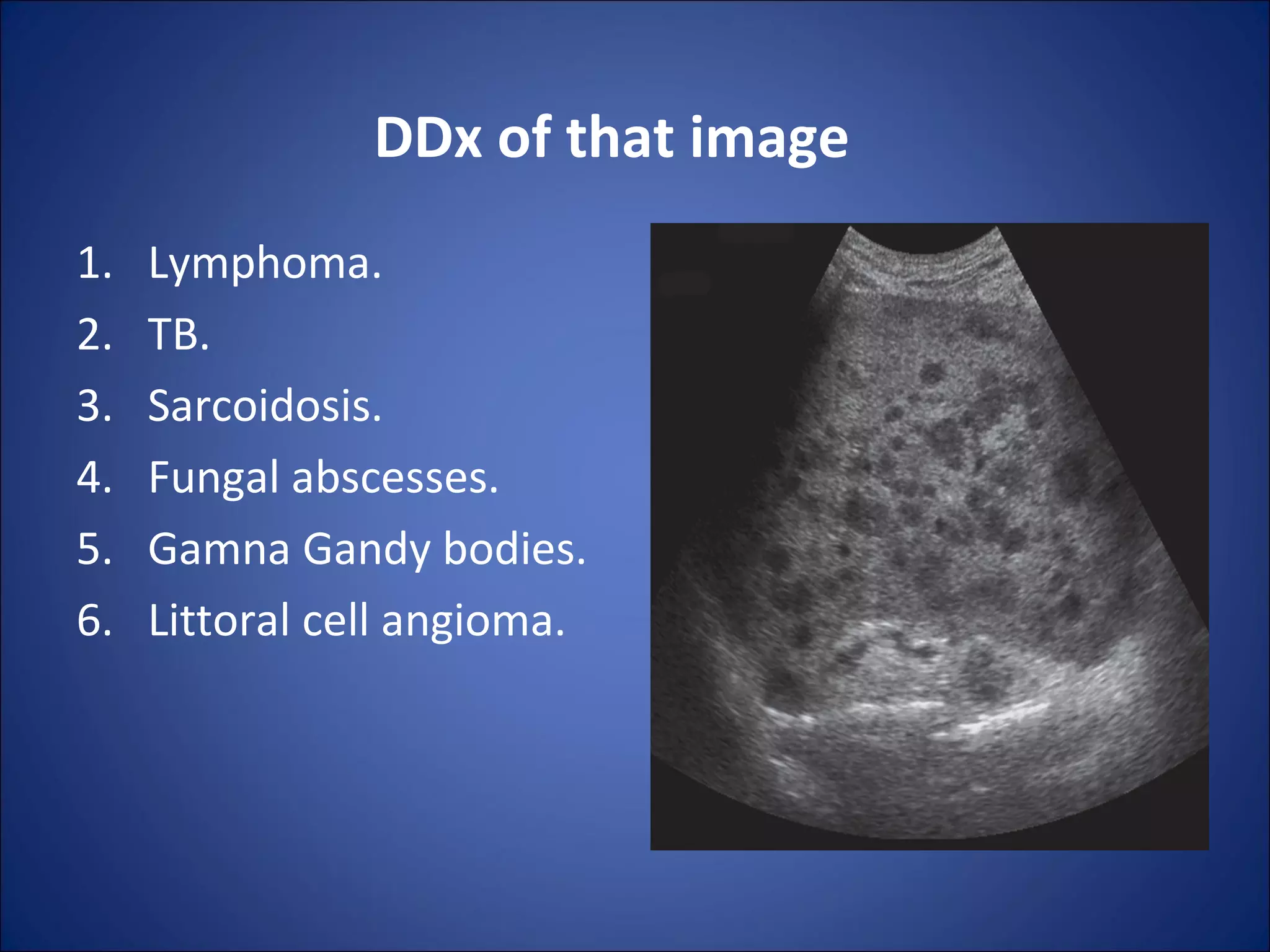 Spleen; Imaging Anatomy, Investigations and Pathology | PPT