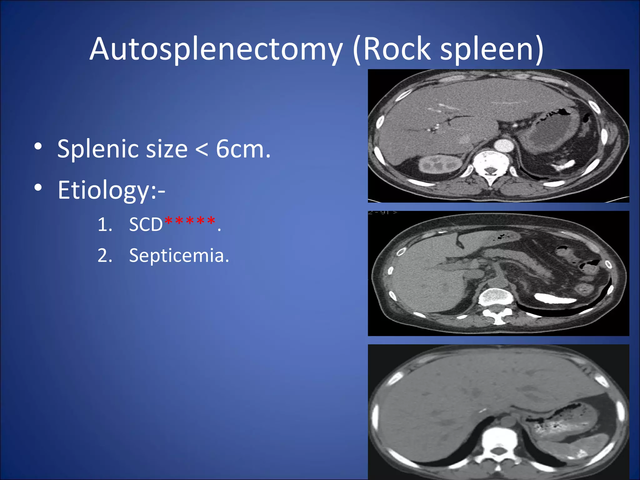 Spleen; Imaging Anatomy, Investigations and Pathology | PPT