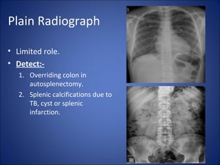 Spleen; Imaging Anatomy, Investigations and Pathology | PPT