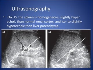 Spleen; Imaging Anatomy, Investigations and Pathology | PPT