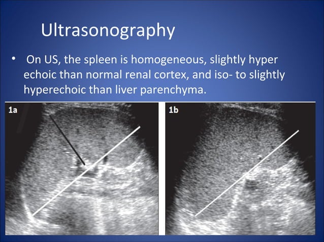 Spleen; Imaging Anatomy, Investigations and Pathology | PPT