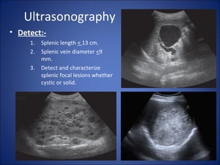 Spleen; Imaging Anatomy, Investigations and Pathology | PPT