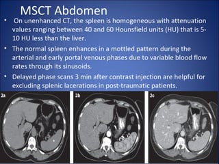 Spleen; Imaging Anatomy, Investigations and Pathology | PPT