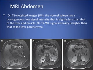 Spleen; Imaging Anatomy, Investigations and Pathology | PPT