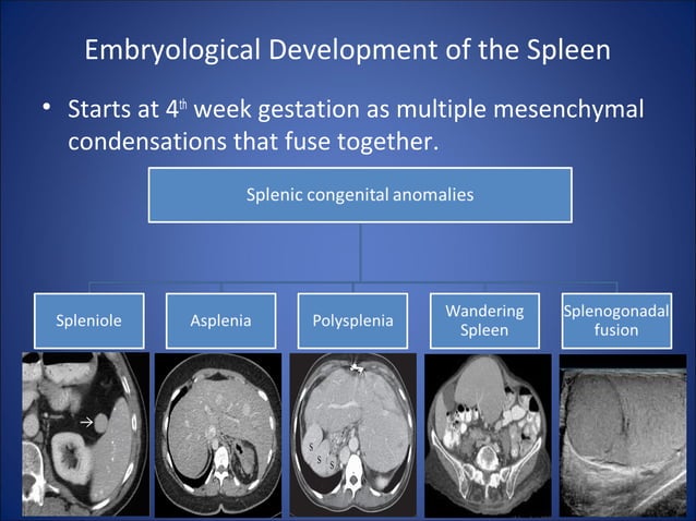 Spleen; Imaging Anatomy, Investigations and Pathology | PPT