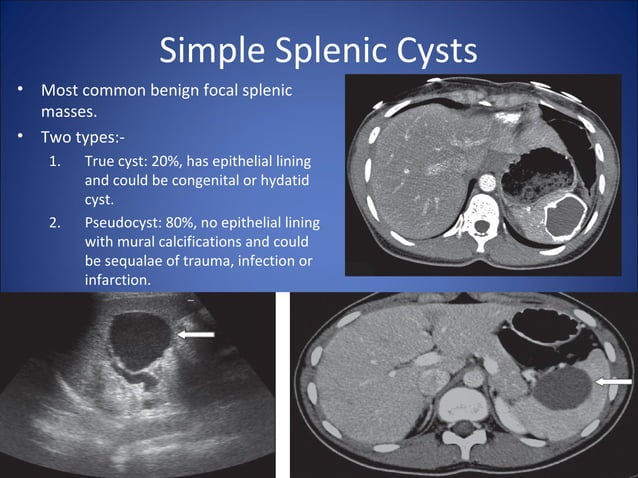Spleen; Imaging Anatomy, Investigations and Pathology | PPT