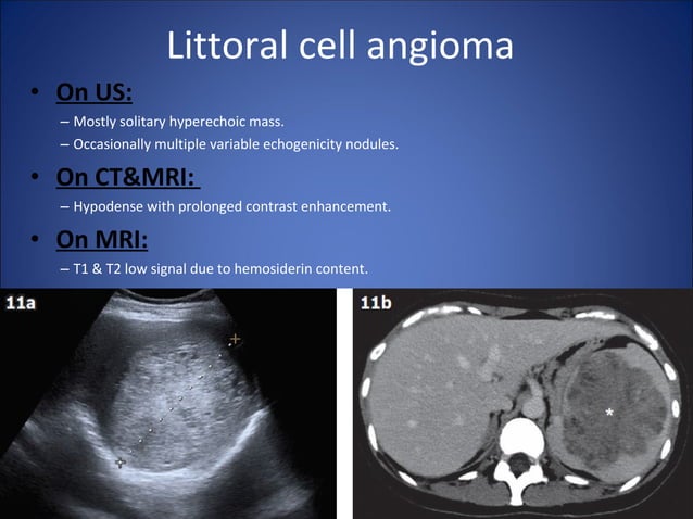 Spleen; Imaging Anatomy, Investigations and Pathology | PPT