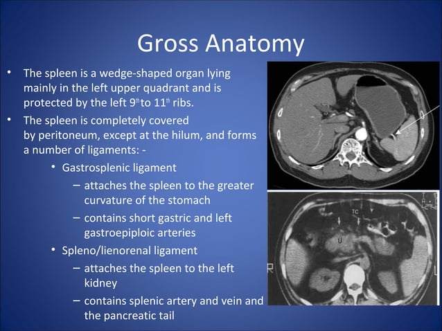 Spleen; Imaging Anatomy, Investigations and Pathology