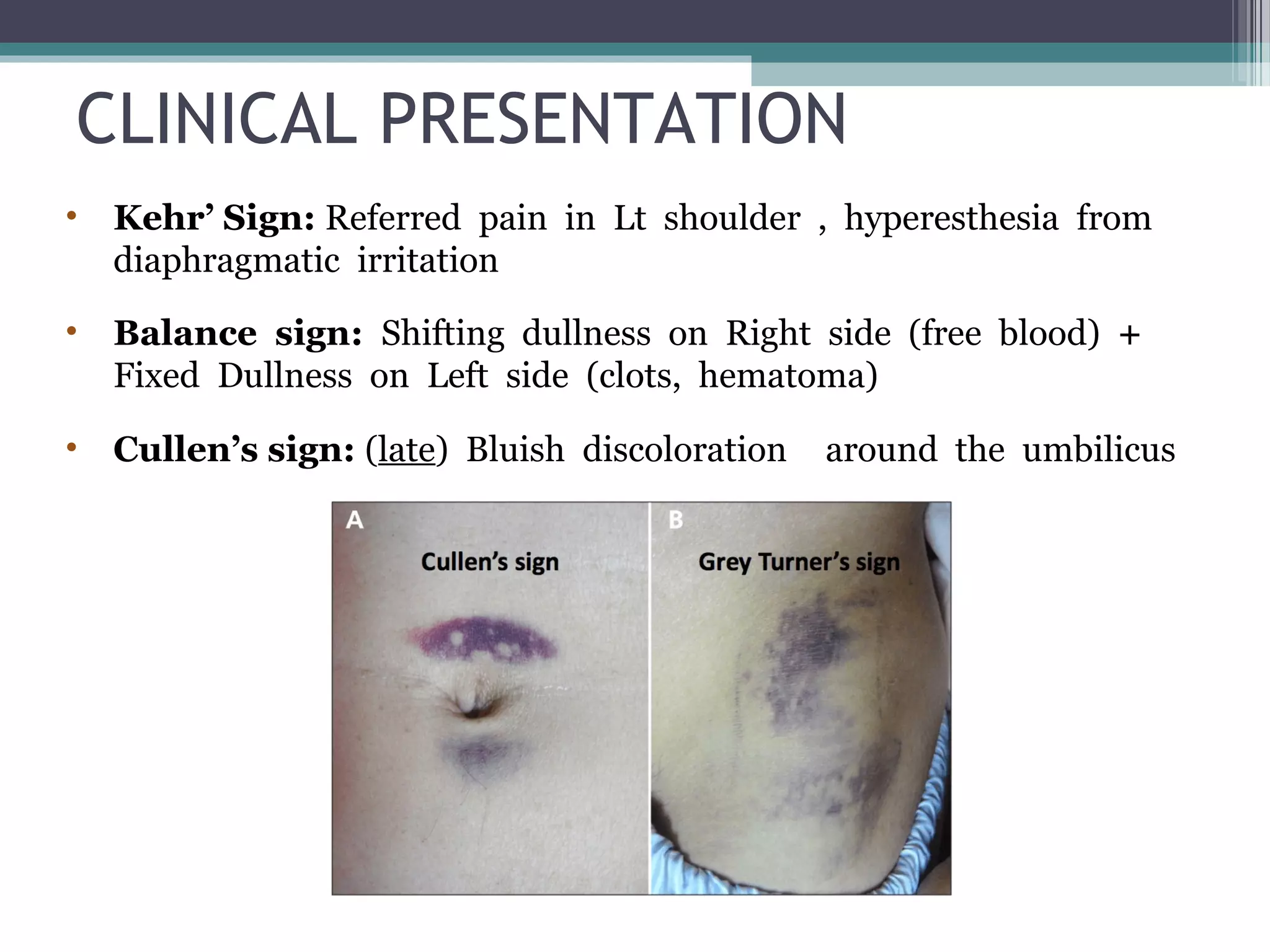 Spleen in surgery | PPT