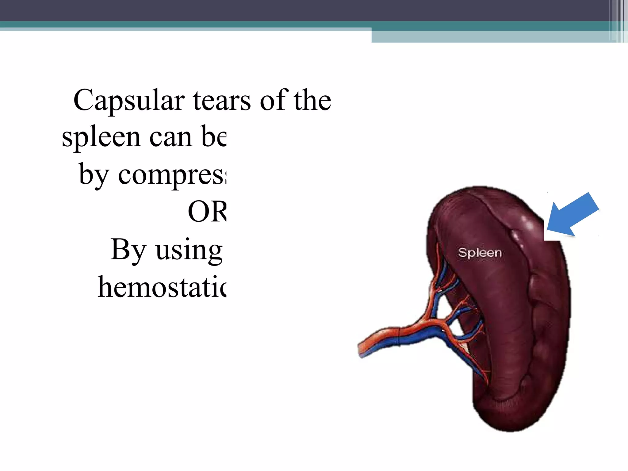 Spleen in surgery | PPT