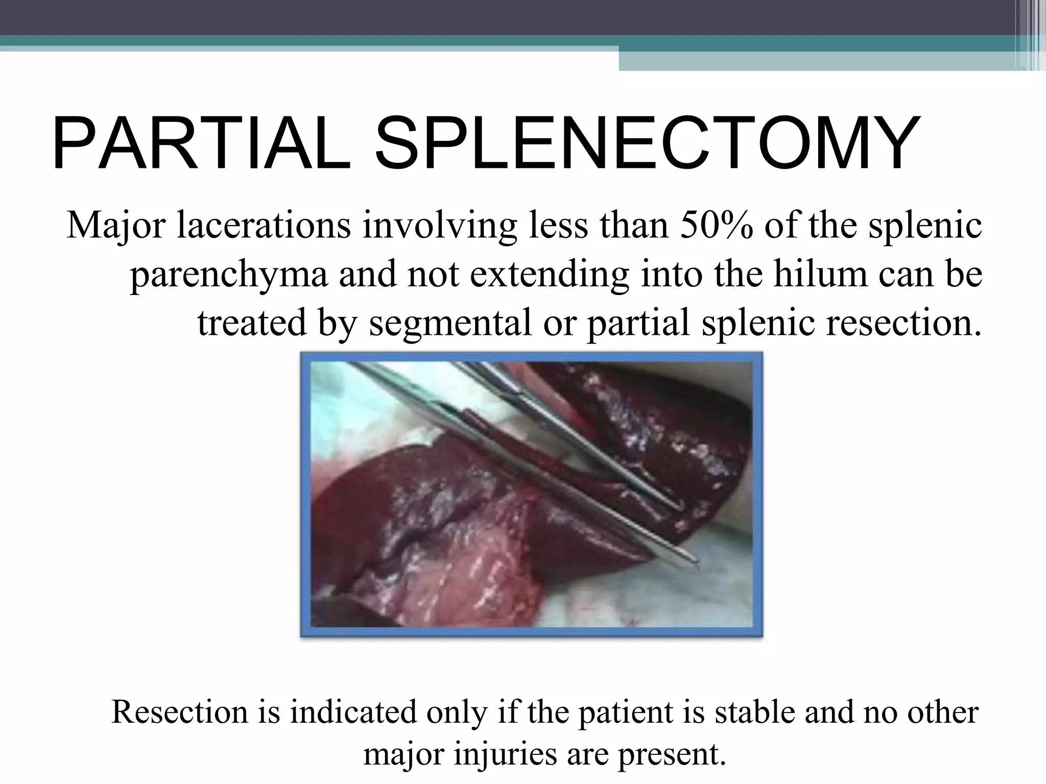 Spleen in surgery | PPT