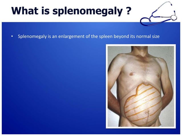 spleen power point by doctor ahmed .ppt.ppt