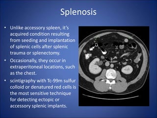Spleen.pptx