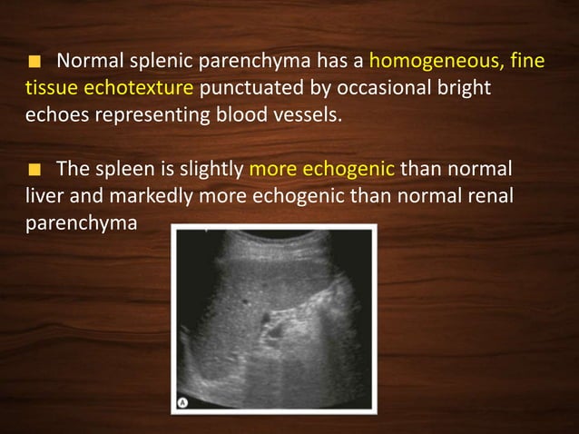 Spleen[1] | PPTX | Death, Injury, or Military Conflict | Sensitive Topics