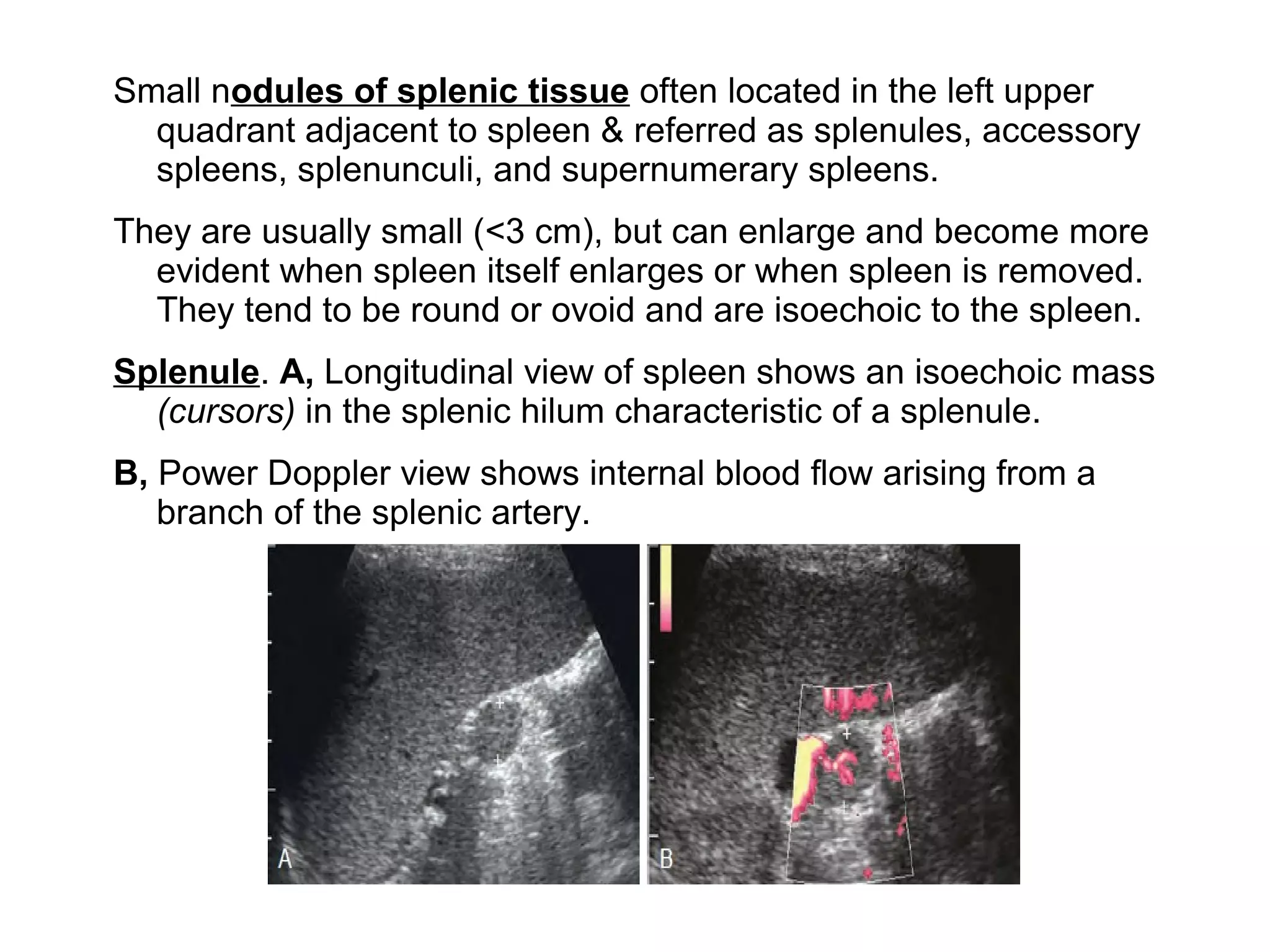 Spleen Ultrasound anatomy structure scanning techniques and pathologies ...