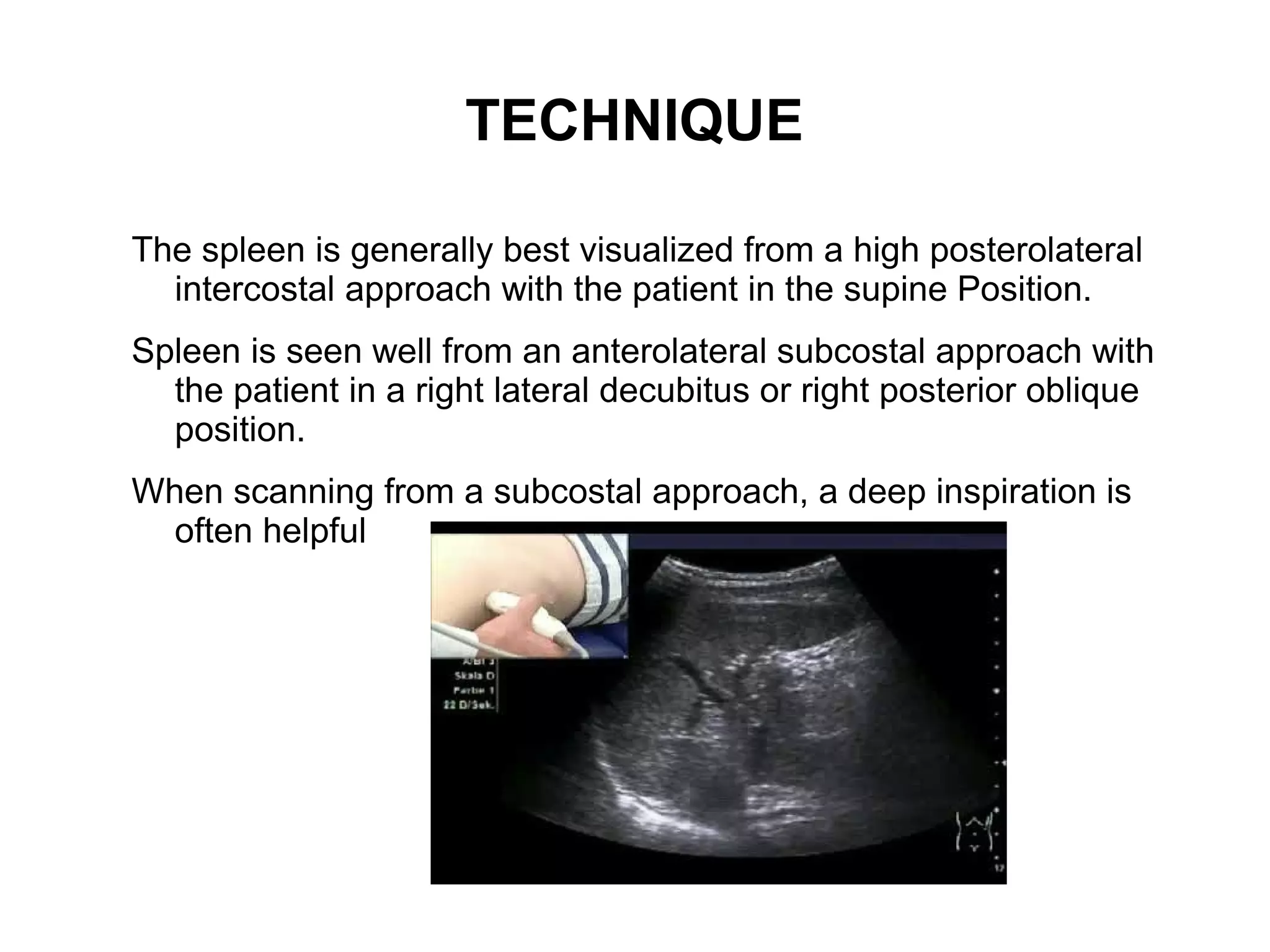 Spleen Ultrasound anatomy structure scanning techniques and pathologies ...