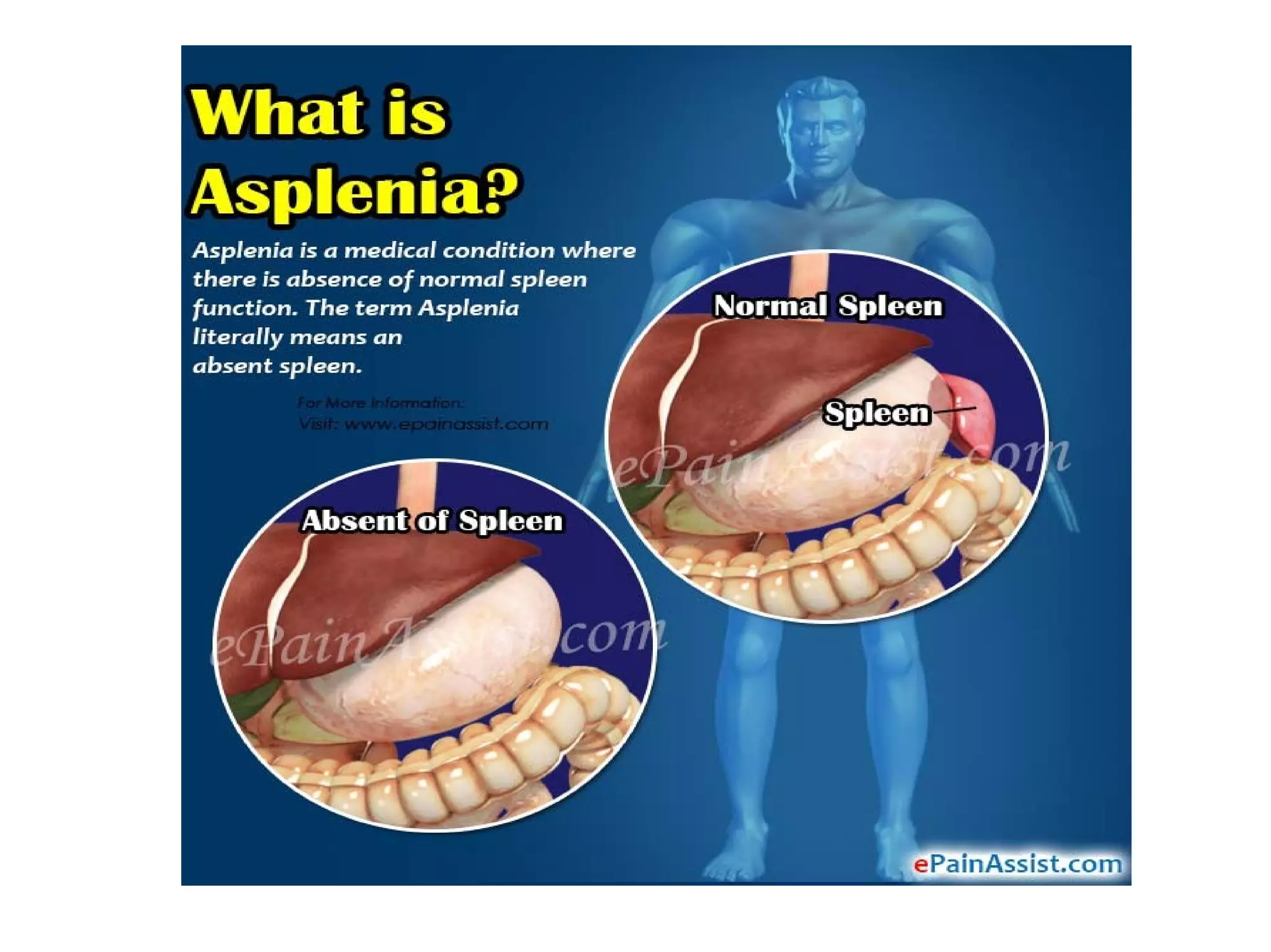 Spleen Ultrasound anatomy structure scanning techniques and pathologies ...