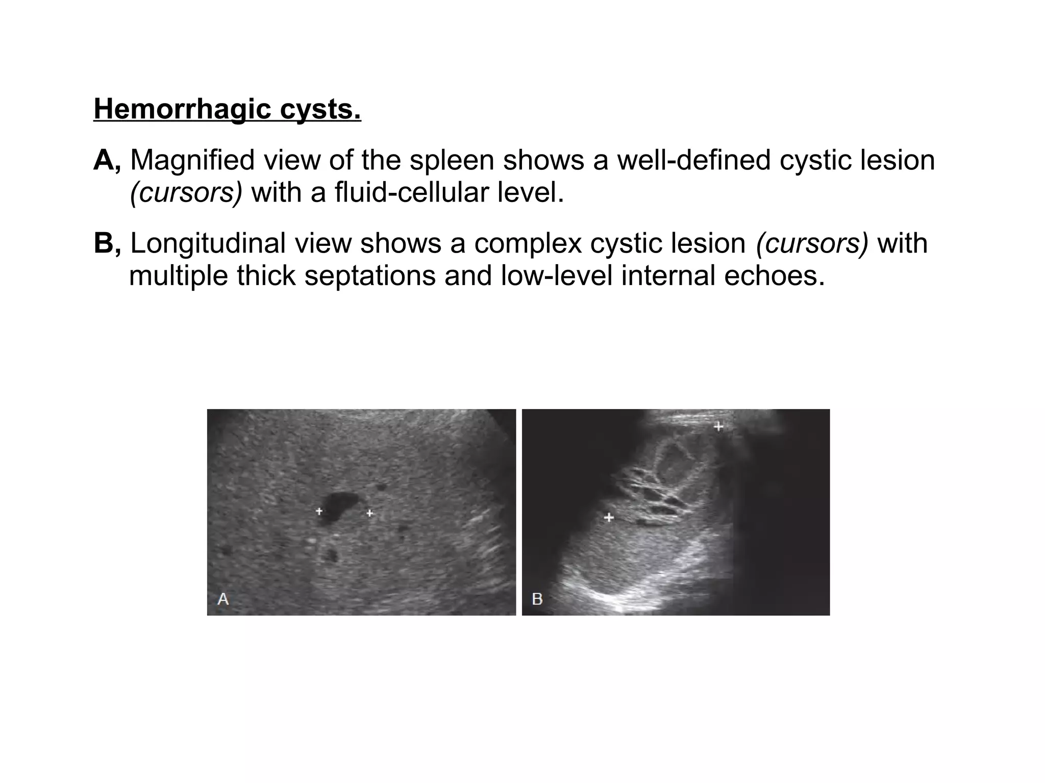 Spleen Ultrasound anatomy structure scanning techniques and pathologies ...