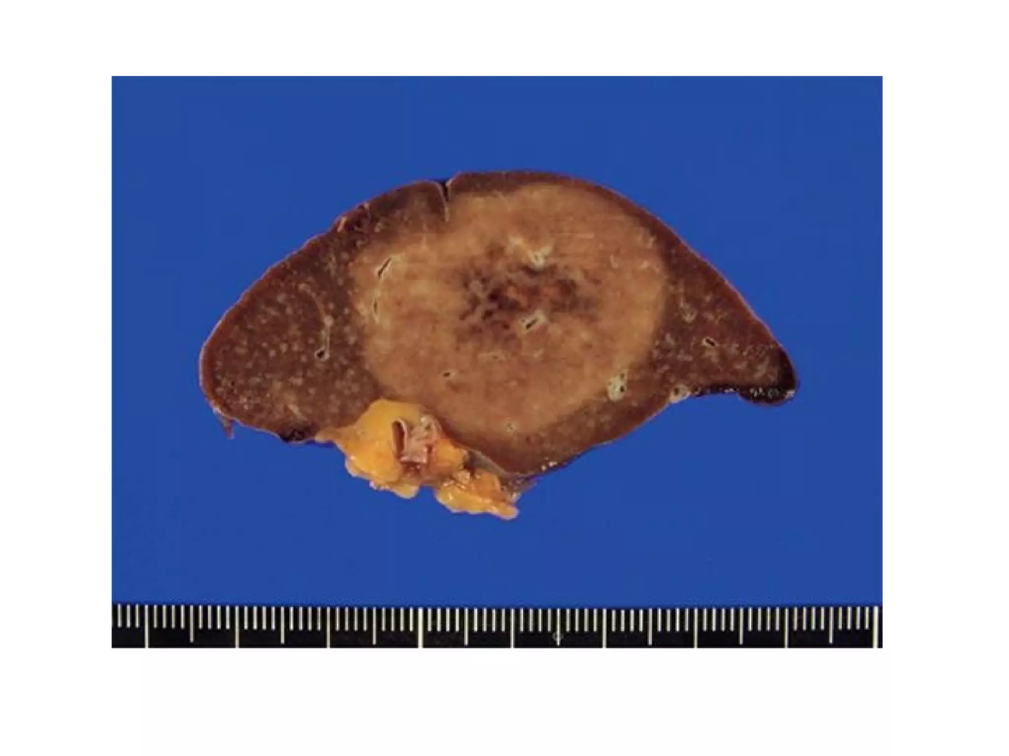 Spleen Ultrasound anatomy structure scanning techniques and pathologies ...