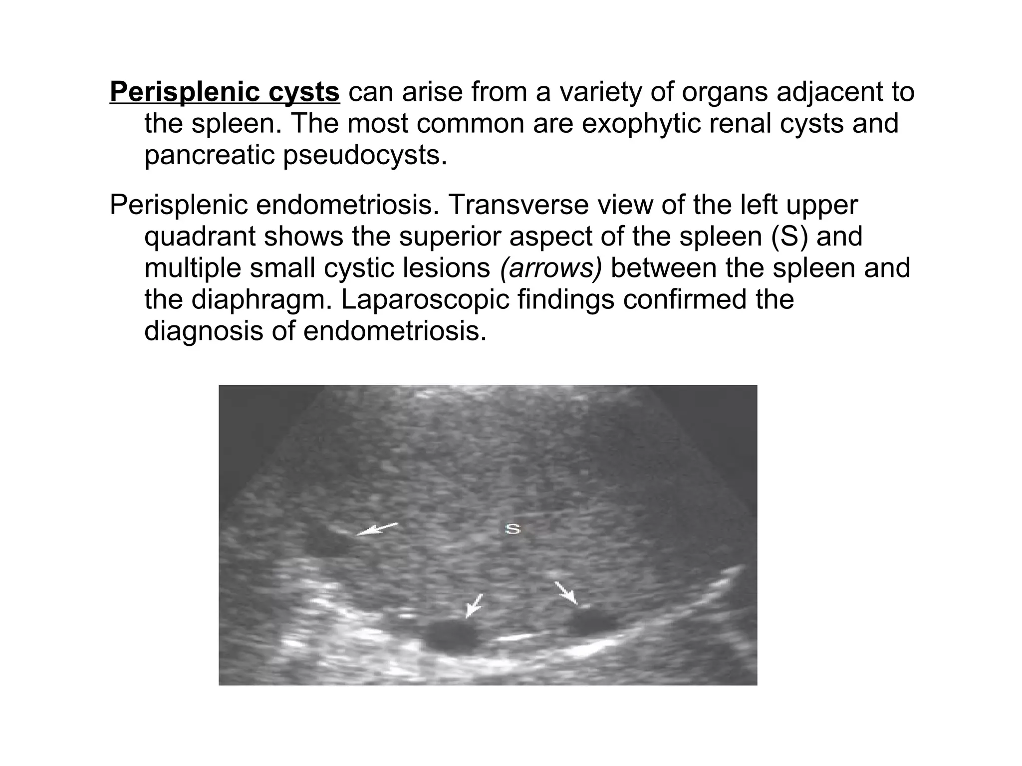 Spleen Ultrasound anatomy structure scanning techniques and pathologies ...