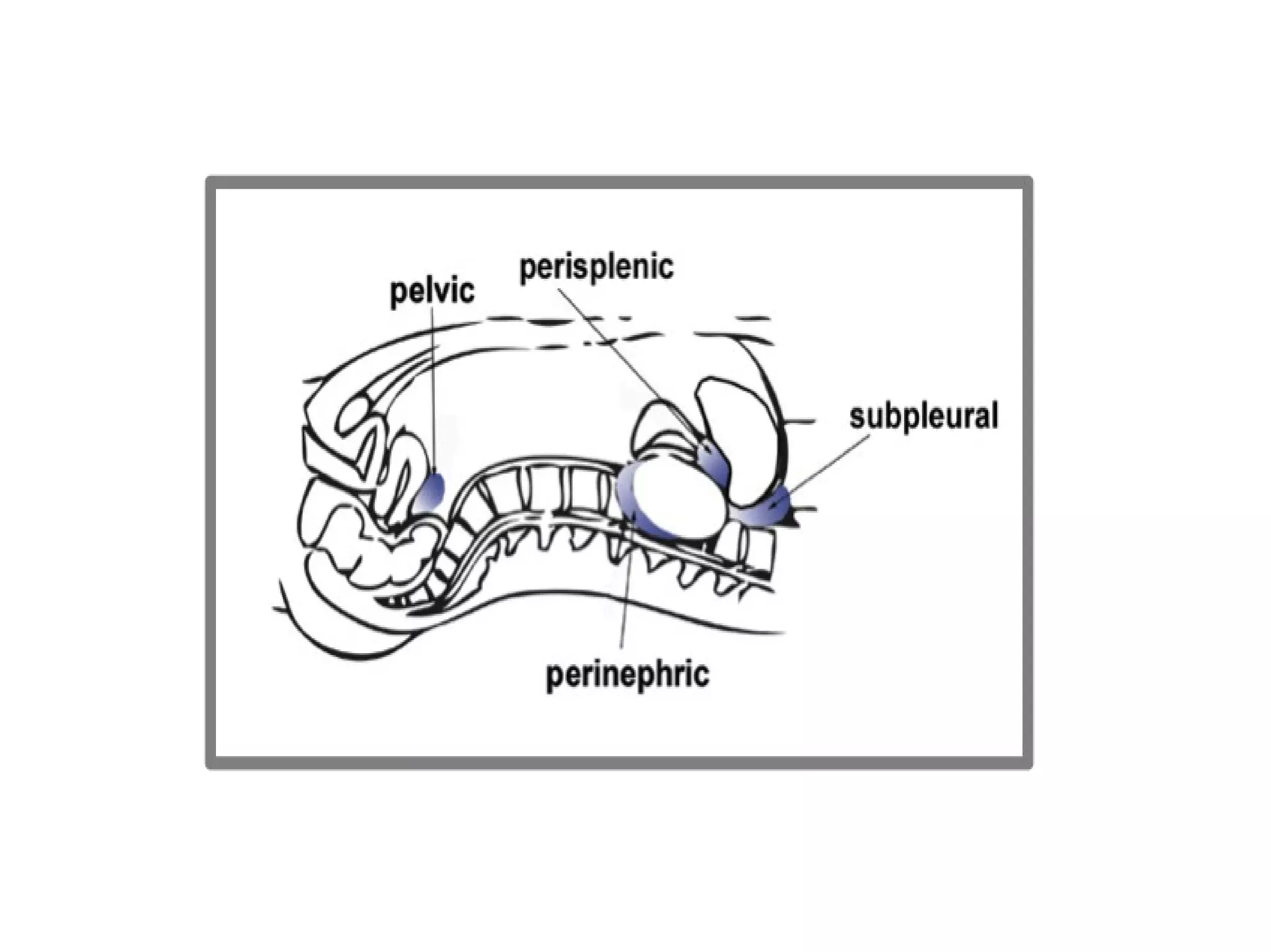 Spleen Ultrasound anatomy structure scanning techniques and pathologies ...