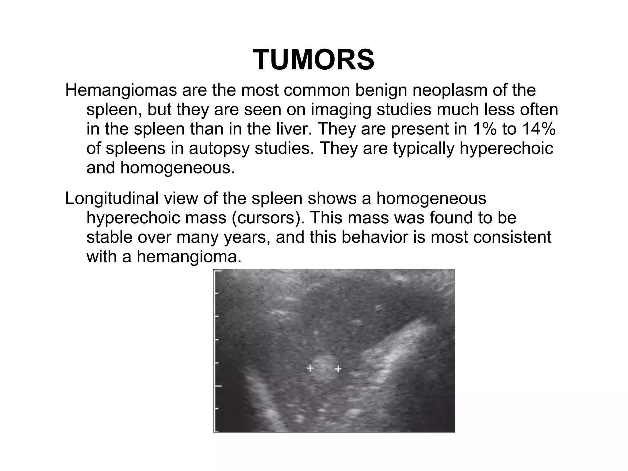 Spleen Ultrasound anatomy structure scanning techniques and pathologies ...