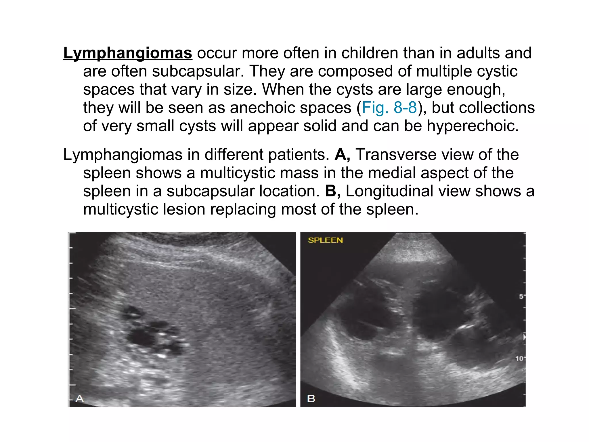 Spleen Ultrasound anatomy structure scanning techniques and pathologies ...