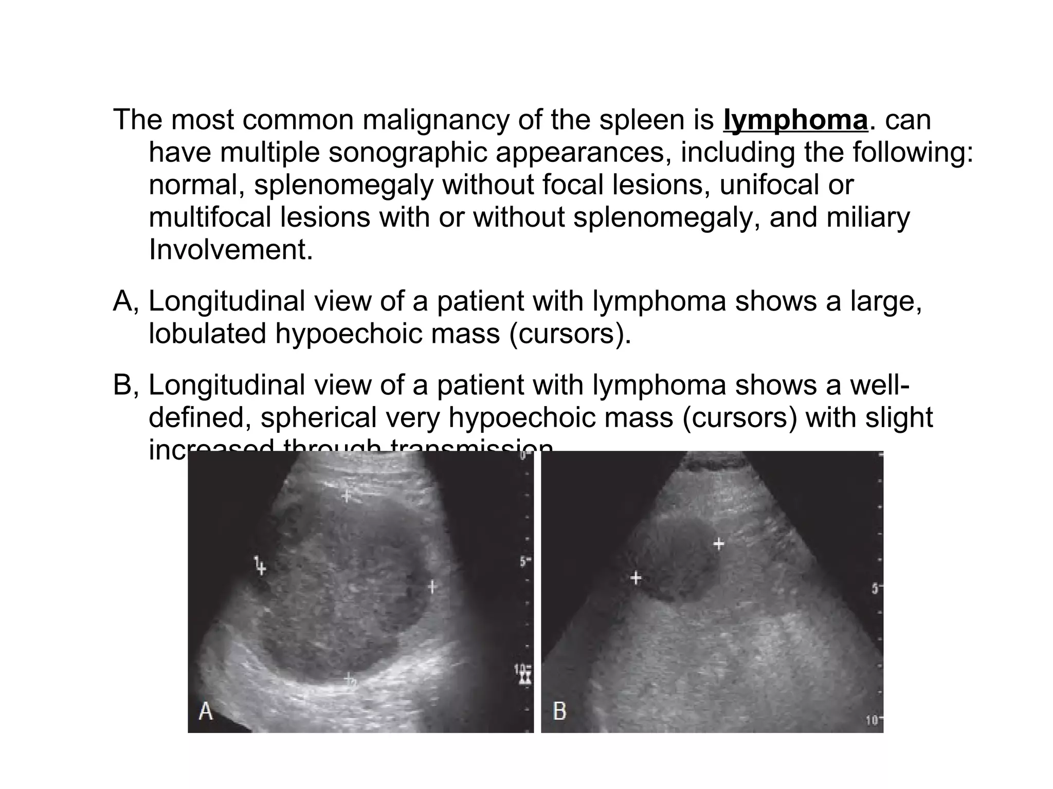 Spleen Ultrasound anatomy structure scanning techniques and pathologies ...
