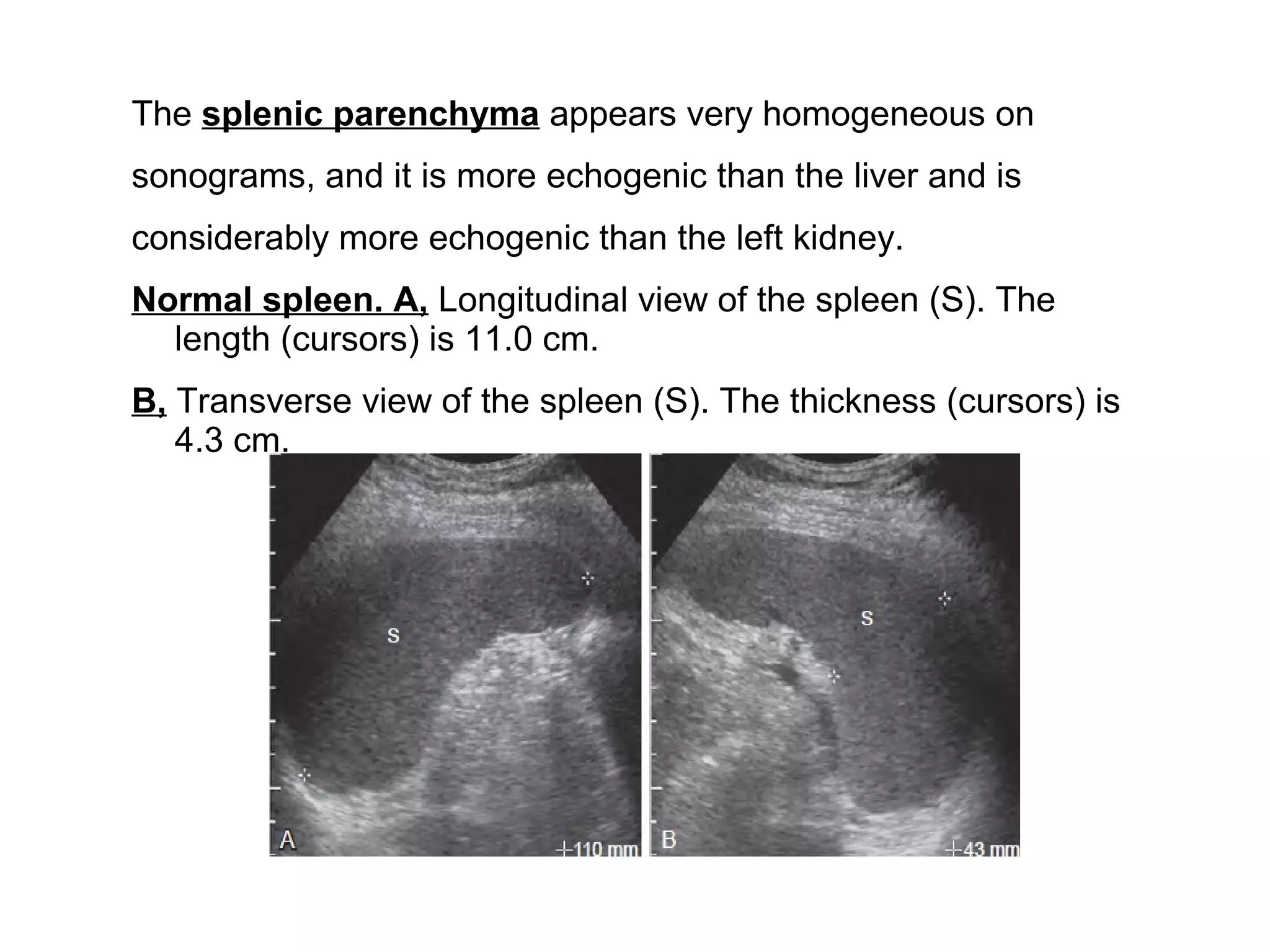 Spleen Ultrasound anatomy structure scanning techniques and pathologies ...