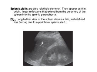 Spleen Ultrasound anatomy structure scanning techniques and pathologies ...