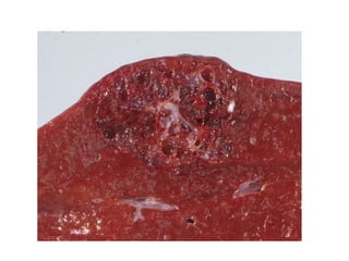 Spleen Ultrasound anatomy structure scanning techniques and pathologies ...