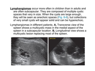 Spleen Ultrasound anatomy structure scanning techniques and pathologies ...