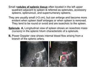 Spleen Ultrasound anatomy structure scanning techniques and pathologies ...